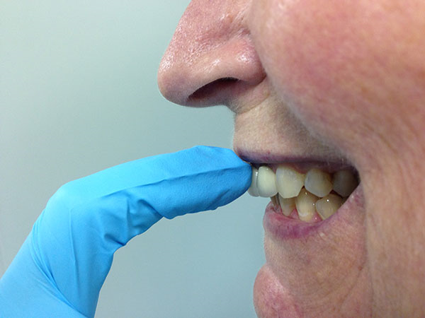 What is fremitus and why should you check for it? - The Dawson Academy