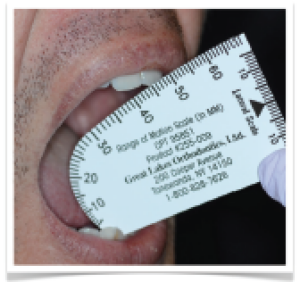 Range of Motion Scale: What Is It and Why Do You Need It? - The Dawson ...