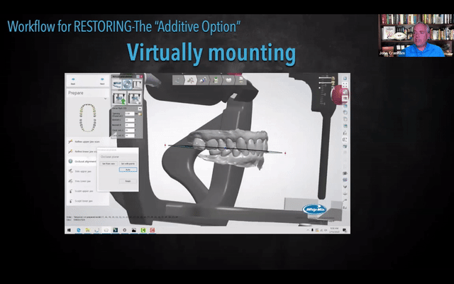 The Management of Worn Anterior Teeth - The Dawson Academy